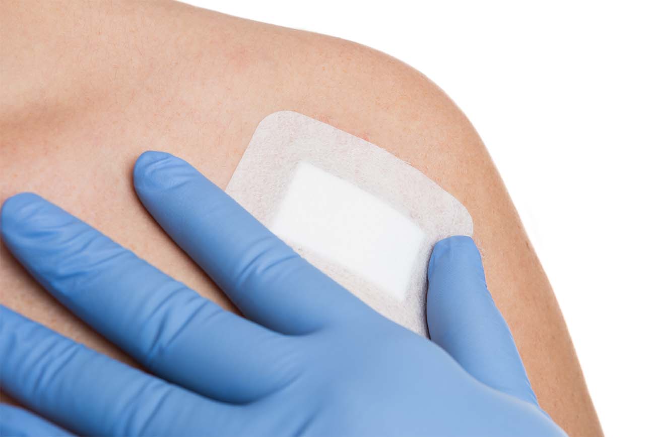 Biopsia cutanea e esame istologico pelle Torino – dermatologo Torino